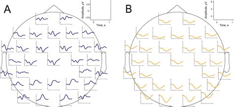 Figures And Data In Event Related Modulation Of Alpha Rhythm Explains The Auditory P300 Evoked