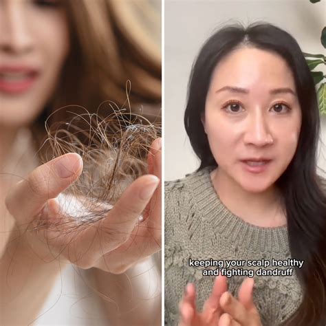 A Derm Shares 3 Things She D Never Do To Her Scalp To Avoid Hair Loss 1 Causes Dead Skin