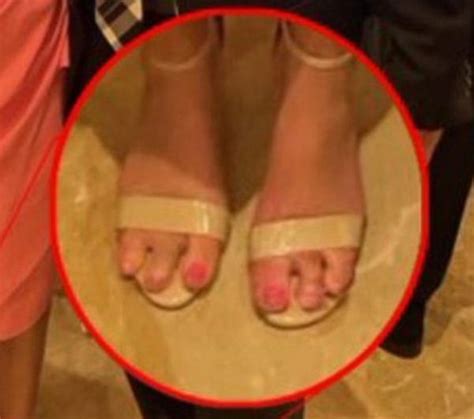 Does Marjorie Taylor Greene Only Have 3 Toes On Each Foot