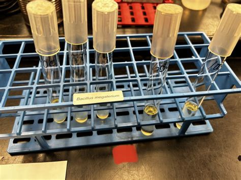 Microbiology FINAL Flashcards Quizlet