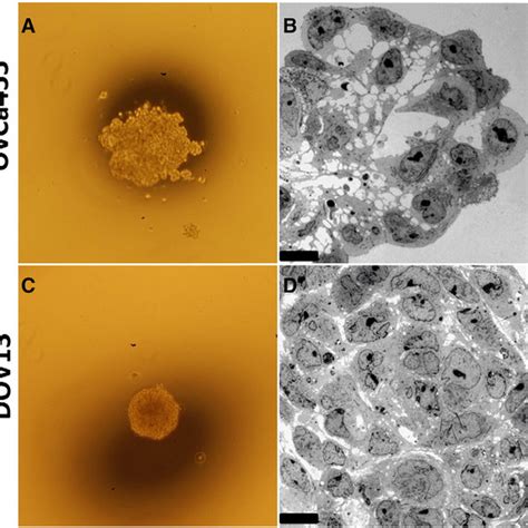 Human Eoc Tissues And Cell Lines Demonstrate Heterogeneous Cadherin