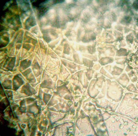 Evaluation Of The Efficiency Of Some Antagonistic Trichoderma Spp In