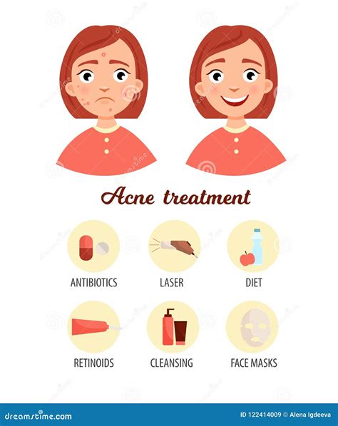Acne Infographics Stock Vector Illustration Of Disease 122414009