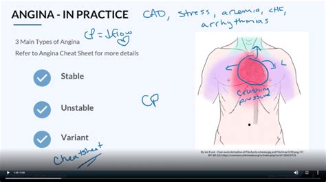 Best Nclex Review Courses 2025 Tested And Ranked