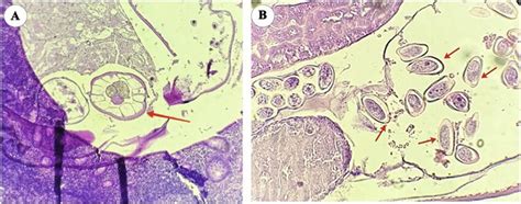 Histopathological Sections Stained With Hematoxylineosin Stain Showing