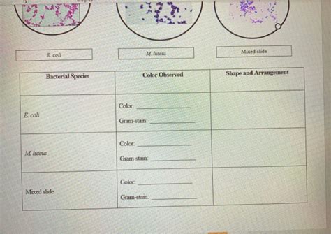 Solved Lab Module 6 Gram Stain Lab Report Name Using The