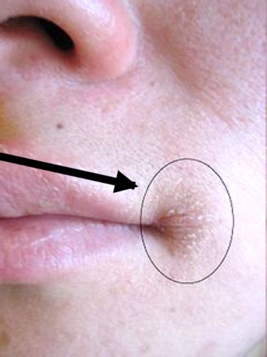 Nutrition Flashcards Quizlet