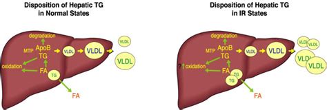 Figure 2 From Increased Very Low Density Lipoprotein Secretion Hepatic