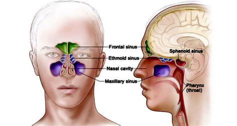 Sphenoid Sinus Tumours