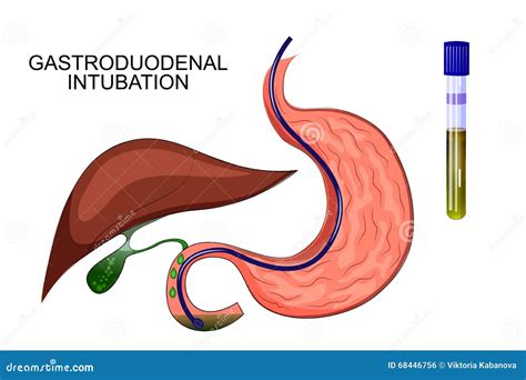 Duodenal Cartoons Illustrations And Vector Stock Images 311 Pictures