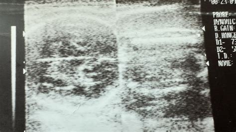 저 어릴때 사진 ㅁㅌㅊ 오덕양성소 에펨코리아