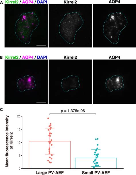 Heterogeneity Of Perivascular Astrocyte Endfeet Depending On Vascular Regions In The Mouse Brain