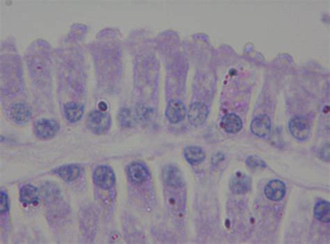 Segregated Simple Columnar Cells With Secretary Bleb Open Phase