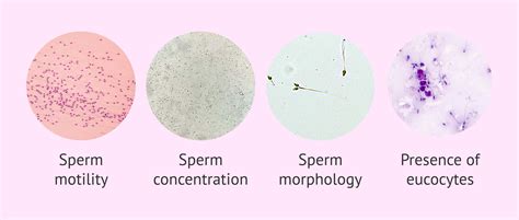 Sperm Microscope