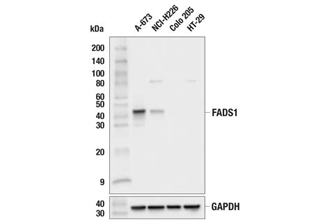 Fads1 F1d2a Rabbit Mab Cell Signaling Technology
