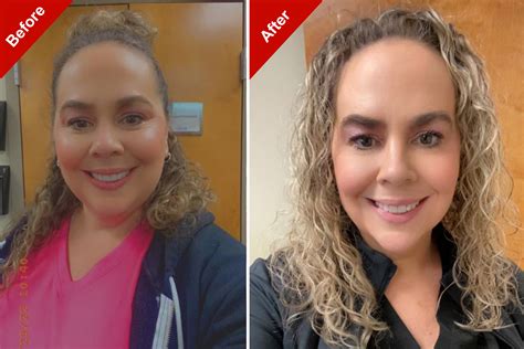 Ozempic Face Vs Buccal Fat Removal Cheap Sale Varsana