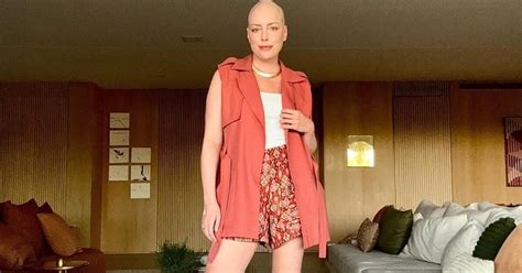 Fabiana Justus Relembra Primeiros Sintomas De Leucemia ‘pouquíssimos