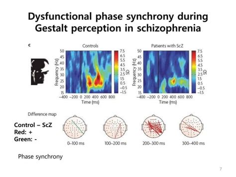 Abnormal Neural Oscillations And Synchrony In Schizophrenia Ppt