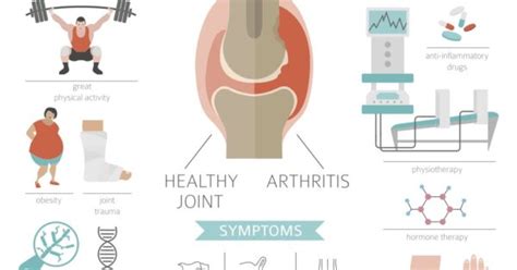 Arthritis Caruso Foot And Ankle
