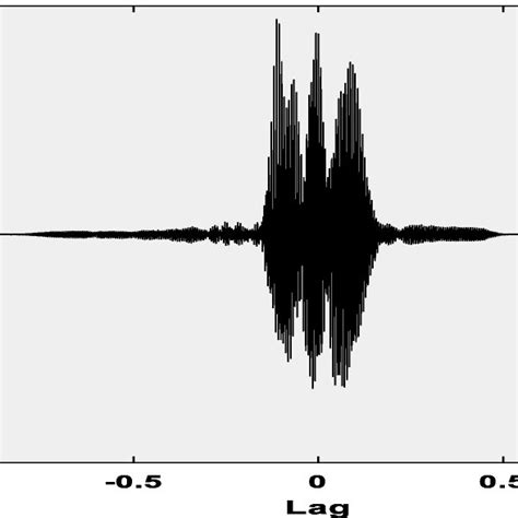 Illustration Of Variations In Speech Signal With Spectrogram