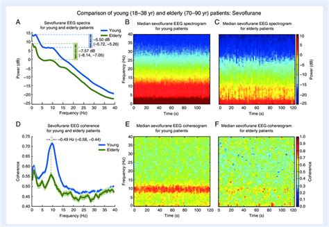 Median Spectra Coherence Spectrograms And Cohereogram Of Young And
