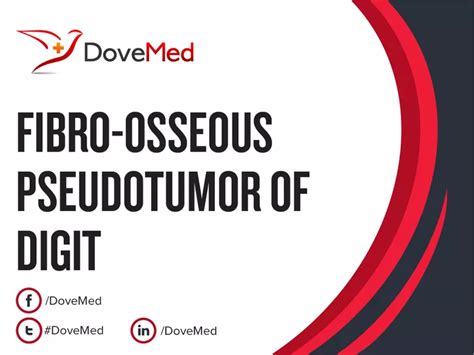 Fibro Osseous Pseudotumor Of Digit Dovemed