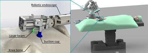 Attachment Strategies For Surgical Robots Department Of Biomedical