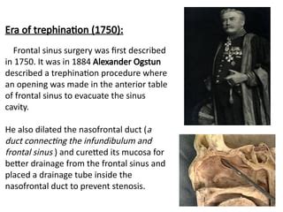 Approach To Frontal Sinus Presentation Pptx