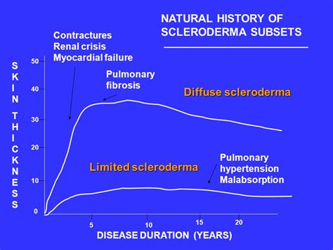Virginia Steen Md Professor Of Medicine Ppt Video Online Download
