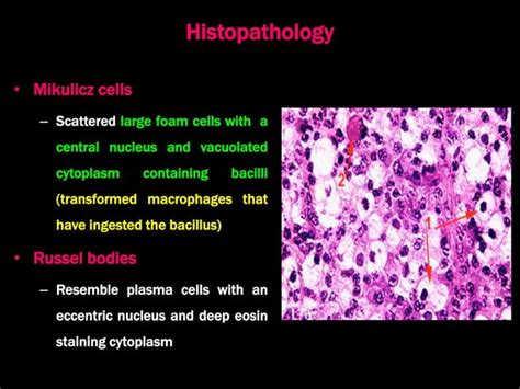 Granulomatous Diseases Of Nose Ppt