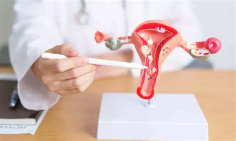 Sex Hormones Increase Endometrial Cancer Risk In Postmenopausal Women