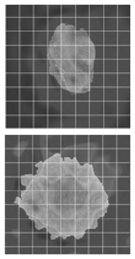 Activation Map For ResNet For An Example Of Melanoma First Row And