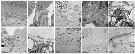 Tem Observations Of Transplanted Rpe Partial Thickness Choroidal Sheets