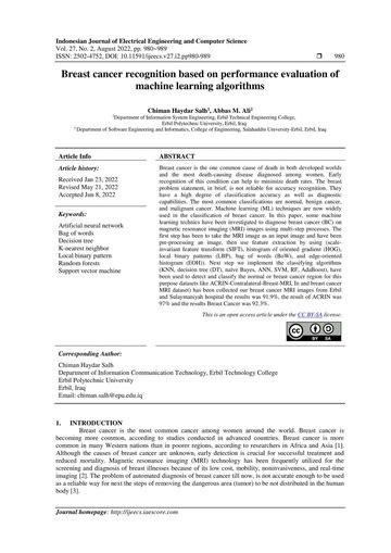 Breast Cancer Recognition Based On Performance Evaluation Of Machine Learning Algorithms