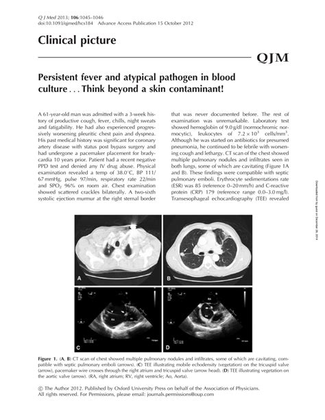 Pdf Persistent Fever And Atypical Pathogen In Blood Culture Think