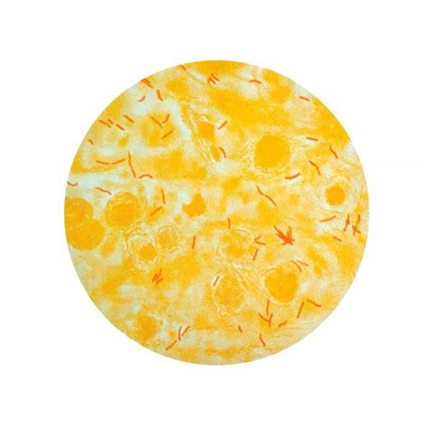 Image 抗酸染色 结核分枝杆菌 Msd诊疗手册专业版