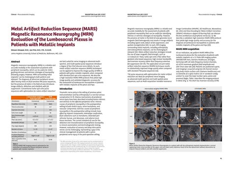 Metal Artifact Reduction Sequence Mrn