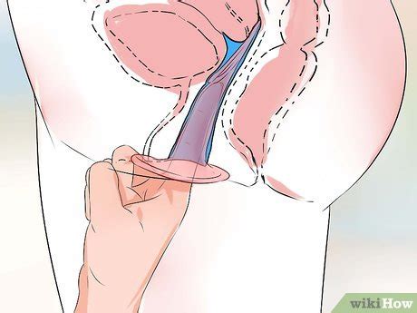 Cara Menggunakan Kondom Dengan Gambar Wikihow