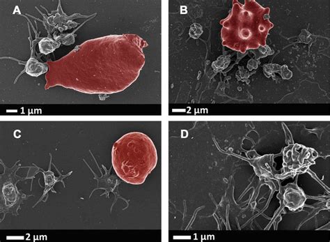 Micrographs from inflammatory diseases where IL 1β IL 6 and IL 8