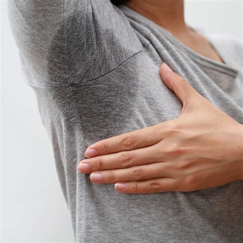 Hyperhidrosis Excessive Sweating Orchid Medical Aesthetics Sunderland