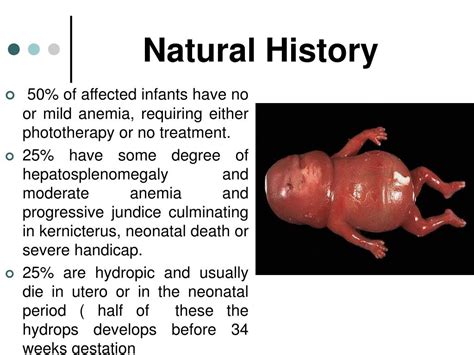 Ppt Rh Isoimmunization And Abo Incompatibility Powerpoint Presentation Id