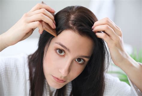 7 Effective Ways To Treat A Dry Scalp Naturally