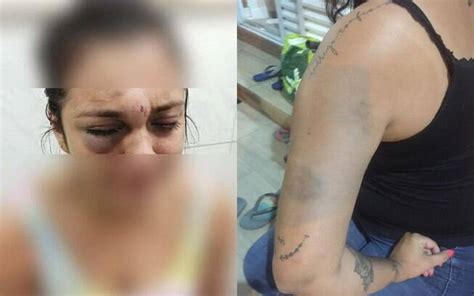 Mulher escreve desabafo após ser agredida pelo namorado e post viraliza
