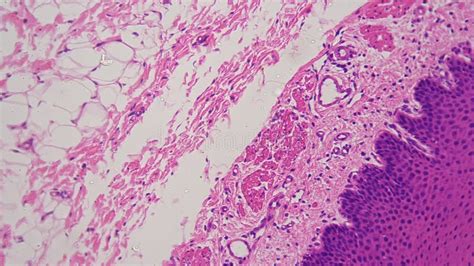 Stratified Squamous Epithelium In Section Filmed By Microscope 100x