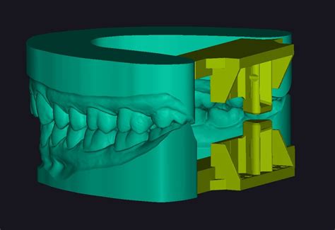 3d File 3shape Articulatior For Exocad 👽 ・template To Download And 3d Print・cults