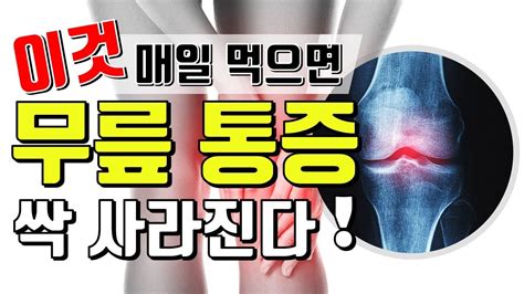 무릎 통증 관절염 매일 이것만 먹었더니 싹 사라졌어요 운동만 하시면 안됩니다 항암 효과와 심장 질환 개선 등 다양한 효능 확인 Youtube
