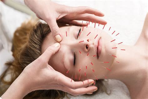Acupuncture Definition History Benefits And Facts Britannica