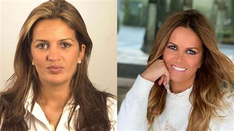 El cambio físico de Marta López tras su paso por el quirófano ni
