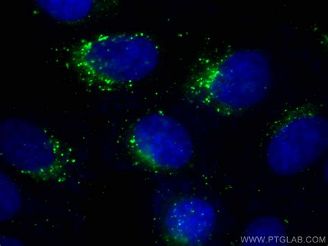 Cathepsin D Antibody 31516 1 Ap Proteintech
