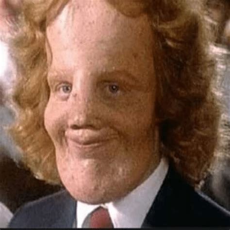 Who Was Rocky Dennis Everything You Need To Know Citimuzik